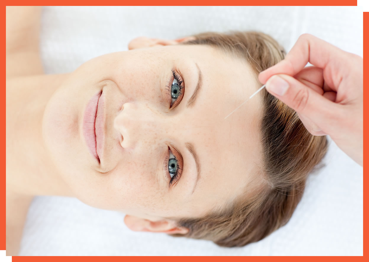 Acupuncture - Churchill Physiotherapy Clinic Inc.